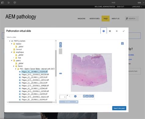 Adobe Experience Manager AEM Pathomation