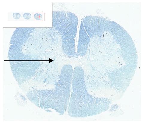 A P Lab Unit The Nervous System Spinal Cord And Spinal Nerve Anatomy Flashcards Quizlet