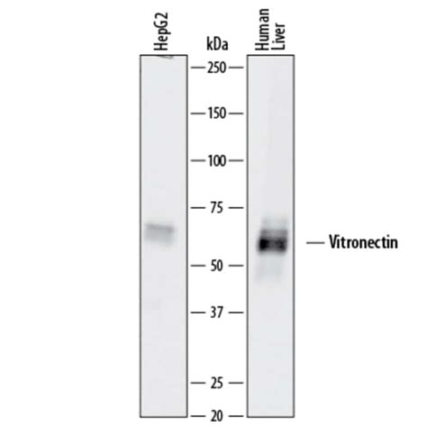 Human Vitronectin Antibody Randd Systems™ 100μg Unlabeled Fisher