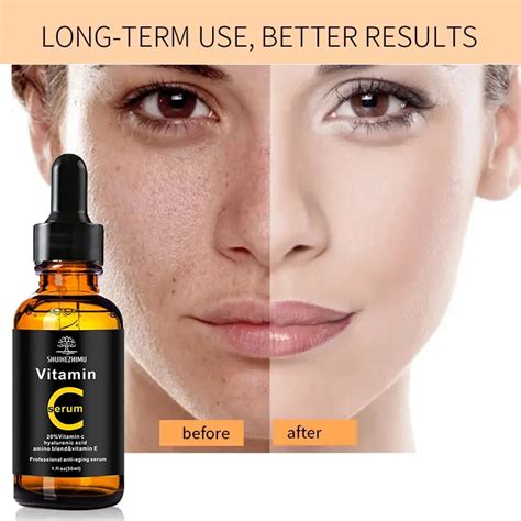 Private Label Skincare Natural 20 Vitamin C Serum Hyaluronic Acid