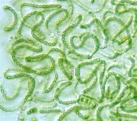 Prokaryote Nostocales Nostoc