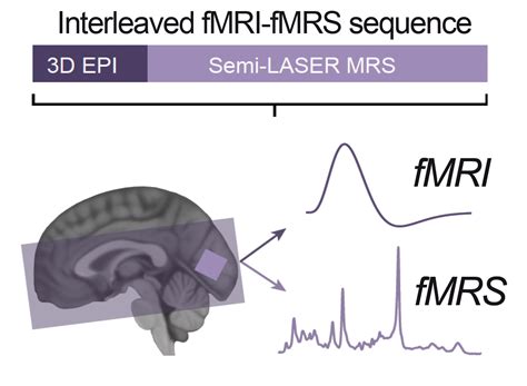 Event Related Functional Magnetic Resonance Spectroscopy