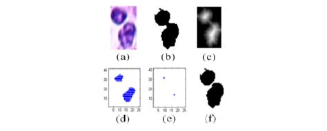 Cell Splitting On Touching Cells A Initial Image B Image After