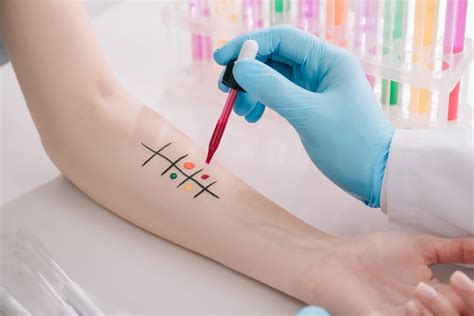 Allergy Skin Test Everything You Need To Know Dr Amy Schiffman Md