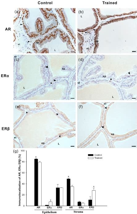 Immunohistochemistry Of The Ventral Prostates Of Rats From The Control