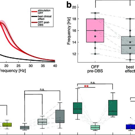Chronic Dbs Suppresses Beta Frequency Band Activity A Mean Power