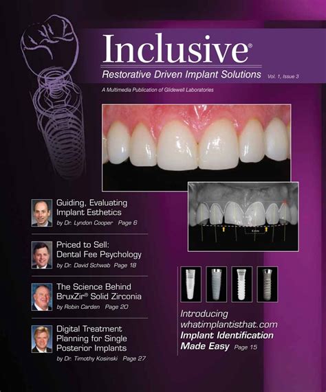 Pdf Download Glidewell Dental Labs