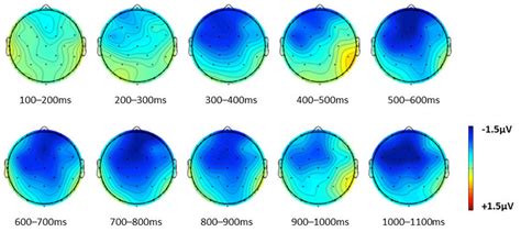 Voltage Maps Showing The Time Course Of The Sustained Negativity Effect