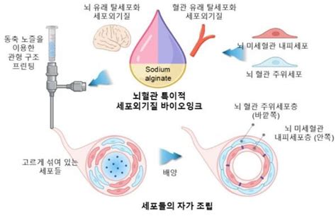 서울대병원 Postech 3d 바이오프린팅 활용한 ‘뇌혈관 장벽 모델 개발