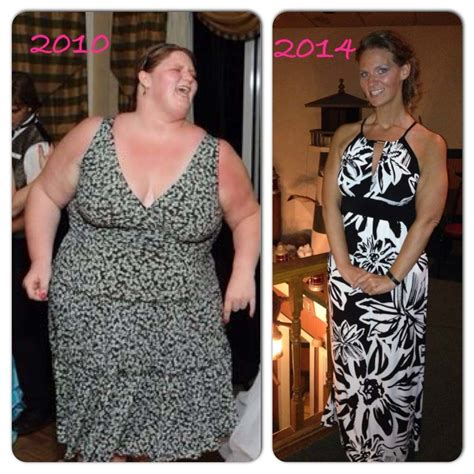 7 Tips To Follow Before And After Gastric Sleeve Surgery Artofit