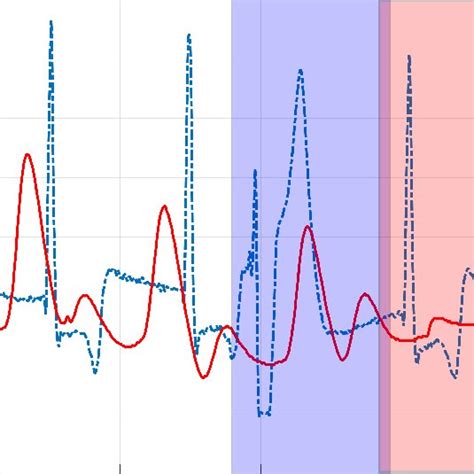 Excerpt Of A Synchronized Recording Of Ecg Blue Dash Dotted And Ppg Download Scientific