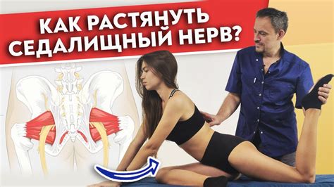 Защемило седалищный нерв — что делать Как разблокировать седалищный