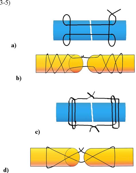 Figure 3 From Flexor Tendon Suturing Techniques Semantic Scholar