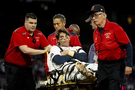 Scary Triston Casas Injury Could Lead To Promotion Of Mlbs Top