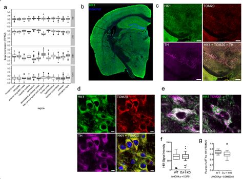 Hexokinase Expression In The Brain And Mitochondrial Detachment Of Hk1 Download Scientific