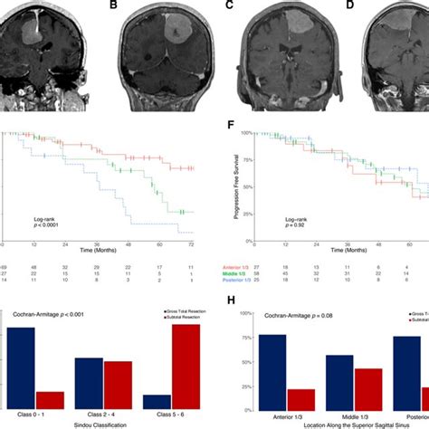 Representative Mri Scans For A Parafalcine Meningioma Sindou Class Download Scientific