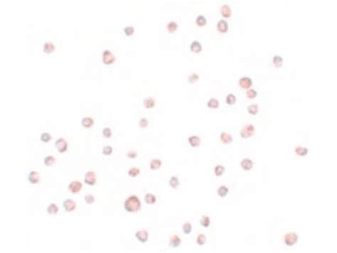 ENC-2 Antibody (200-901-BA4) | Rockland