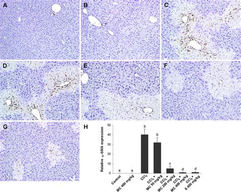 Hepatic Alpha Smooth Muscle Actin α Sma Expression α Sma