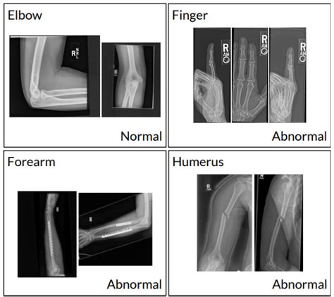 10 Best Free Healthcare Datasets For Machine Learning