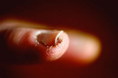 Carolina Naturally Scientists Have Found A Way To Regenerate Skin And
