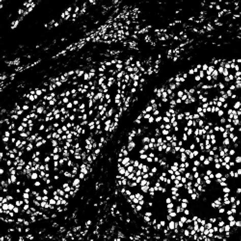 Revised Deep Learning Approach Using Matlab Caffe Python Andrew Janowczyk