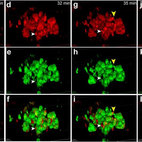 U21 Segregates From Cdmpr In The Golgi Live Imaging Of Rush In Hela