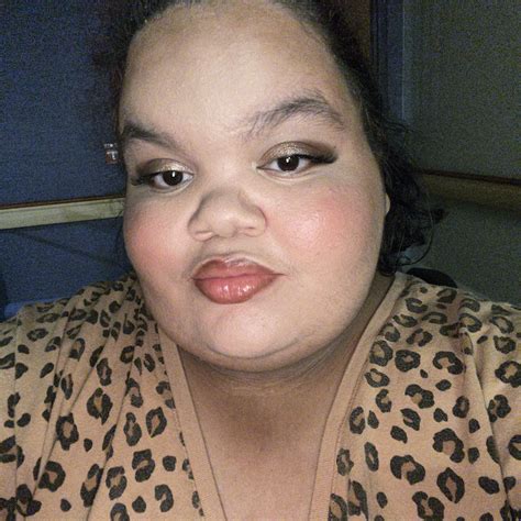 Acanthosis Nigricans Problems🙄 R Makeupaddiction