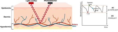 Figure 1 From Non Intrusive Monitoring Of Vital Signs In The Lower