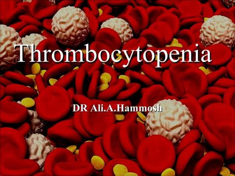 Thrombocytopenia Ppt