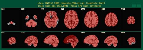 epi mask misalignment after sswarper2 and afni proc py afni message