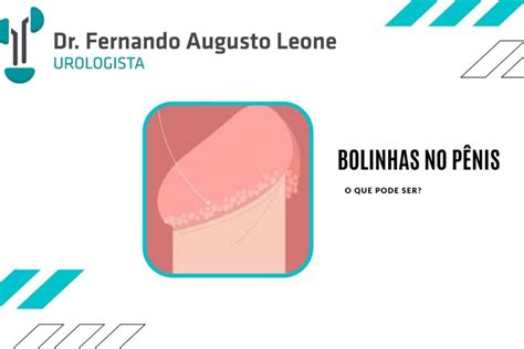 O Que São Essas Bolinhas No Penis Dr Fernando Leone Urologista BH