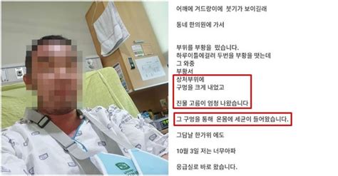 최근 한의원 치료 받다 사망한 사실 밝혀진 유명인 포스트쉐어