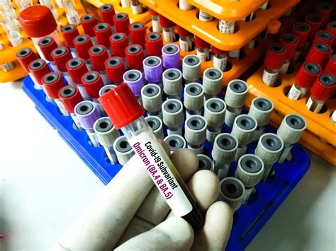 Covid ecco le varianti Omicron più diffuse in Italia Fortune Italia