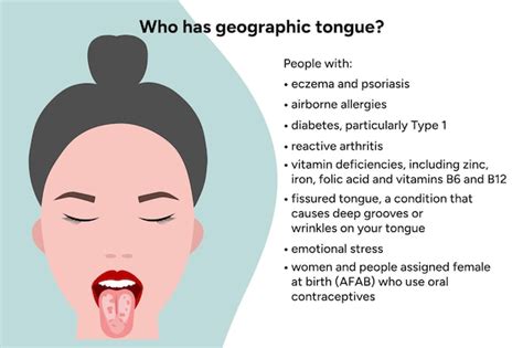 Premium Vector Geographic Tongue Causes Medical Illustration