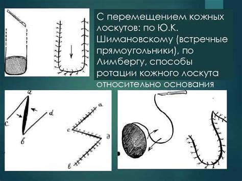 КОЖНЫЙ ШОВ И ОСНОВЫ ПЛАСТИЧЕСКОЙ ХИРУРГИИ