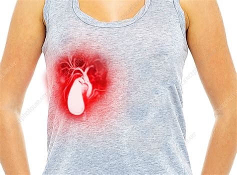 Gall Bladder Composite MRI Scan Stock Image F036 9757 Science