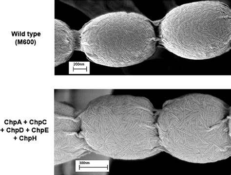 Scanning Electron Micrographs Comparing The Surface Ultrastructure Of