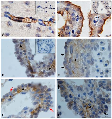 The Expression And Tissue Distribution Of Oatp1c1 And Mct8 Were
