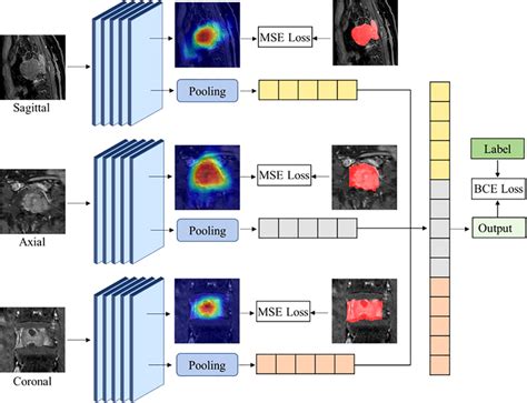 The Overall Framework For The Attention Guided Multi View Spinal
