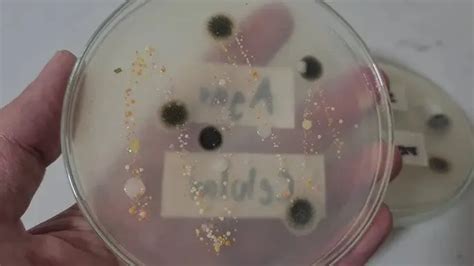 Cultivo de bacterias en agar técnica esencial en microbiología