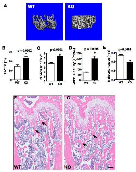 Gpcr Kinase 2 Interacting Protein 1 Git1 Regulates Osteoclast