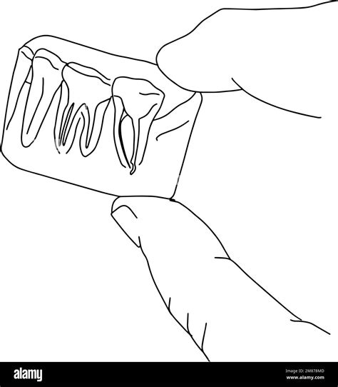 Hand Holding Teeth X Ray Stock Vector Image And Art Alamy