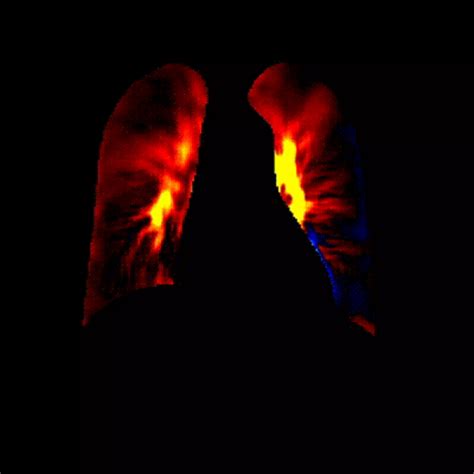 Dynamic Digital Radiography Konica Minolta