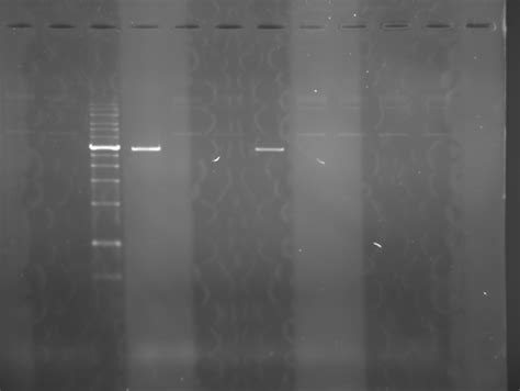 Ligation Problem With My Vector And Insert Researchgate