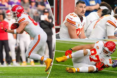Travis Kelce Injured In Chiefs Vs Vikings Game — But Returns To Score