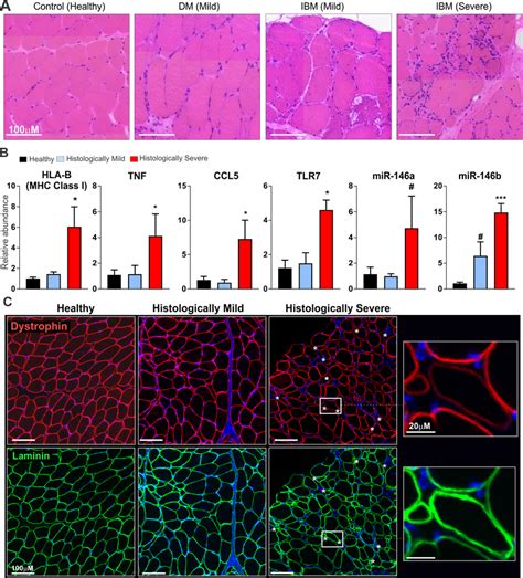 Elevations In Major Histocompatibility Complex Mhc Class I Download Scientific Diagram