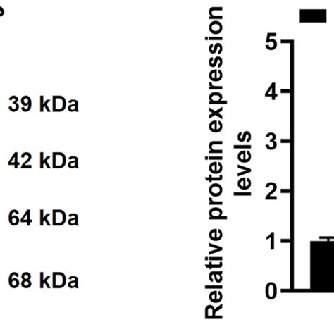 Atg Regulated Nf‐κb Pathway In Il‐1β‐induced Hnpcs The Protein Levels