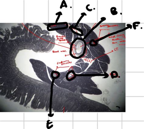 Micro Anatomy Pancreas And Liver Flashcards Quizlet