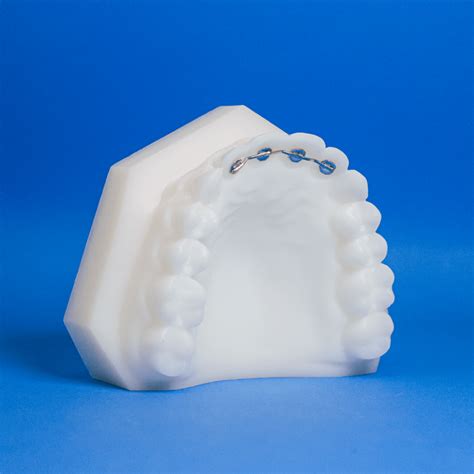 Mesh Fixed Lingual Retainers Ordont Orthodontic Appliance Lab