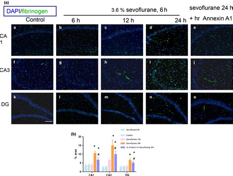 The Role Of The Wntβ‐catenin‐annexin A1 Pathway In The Process Of
